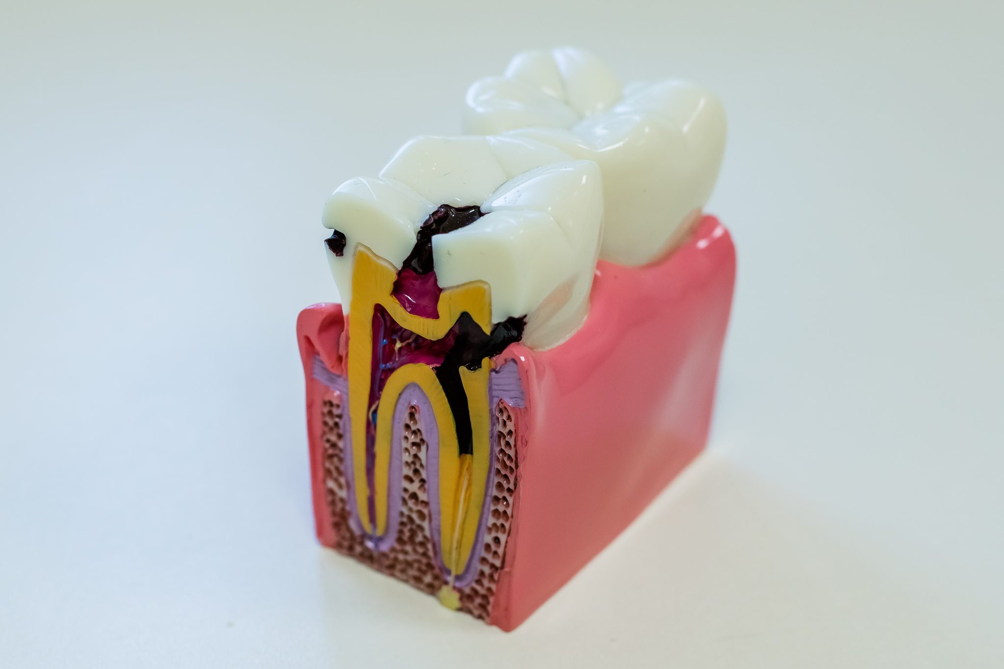 ¿Cuáles son las partes de un diente?