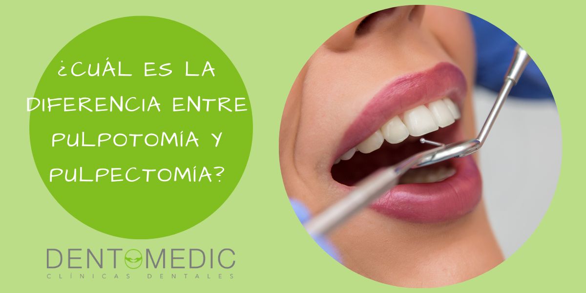 Pulpotomía y pulpectomía: Causas del dolor de dientes y cuidado dental